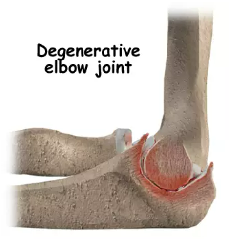 ΑΡΘΡΙΤΙΔΑ ΑΓΚΩΝΑ | Απόστολος Προδρομίδης